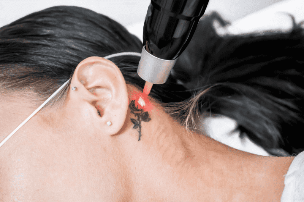 PicoSure vs. PicoWay: What’s the Difference?